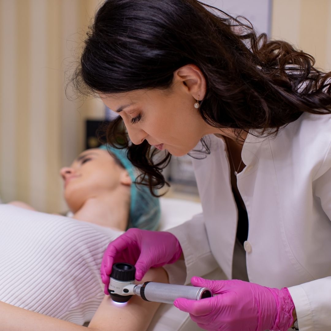 Keratoza Seboreica – Dermaceutica – SkinCare